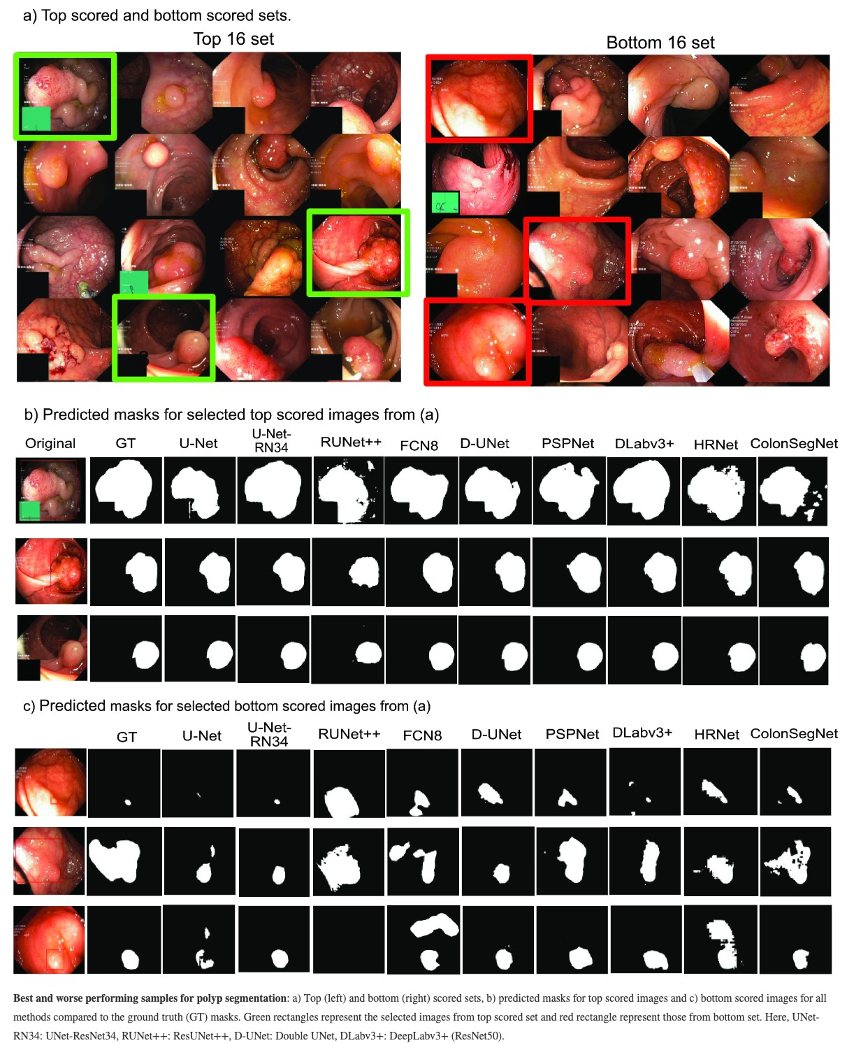 ColonSegNet for Real-time Polyp Segmentation - Debesh Jha